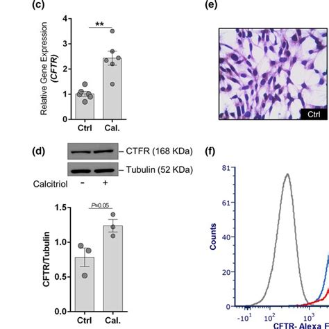 Calcitriol Induces The Expression Of Cystic Fibrosis Transmembrane