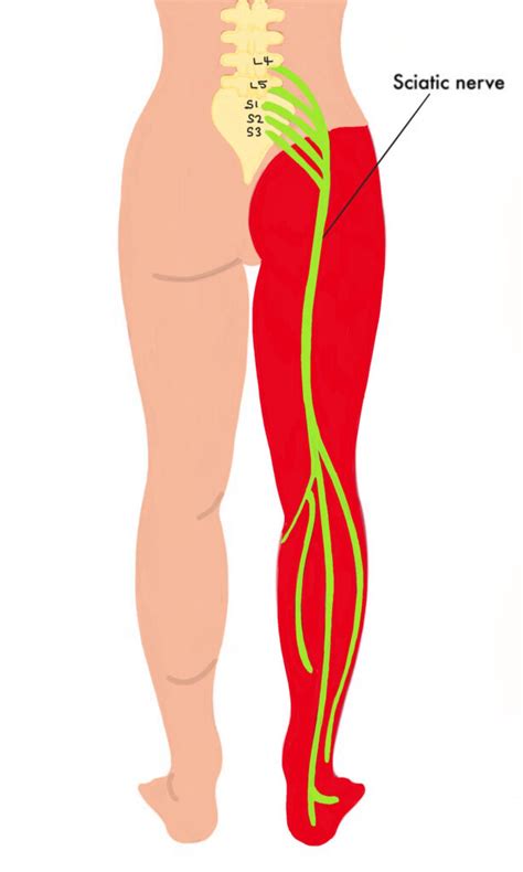 Sciatica Dermatome Map Dermatome Map