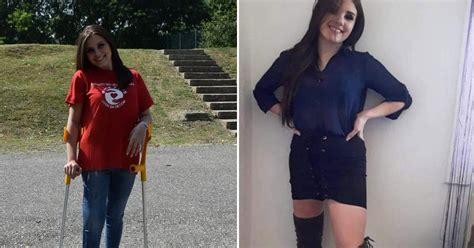 Ivana Iz Loznice Sa 16 Godina Otkrila Da Ima Rak Ortoped Je Ubeđivao