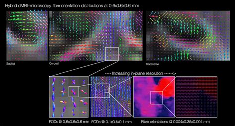 Reconstructing Fibre Orientation Distributions Fods From The Hybrid Download Scientific