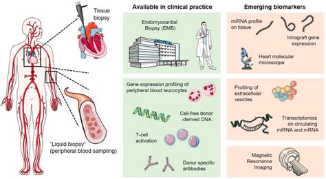 Invasive And Non Invasive Approaches In Cardiac Allograft Rejection