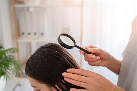 O Que é Dermatite Seborreica Dermatolaser
