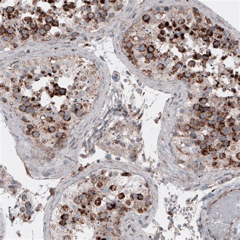 Mouse Monoclonal Anti Lamp1 Antibody Buy For Research Highly