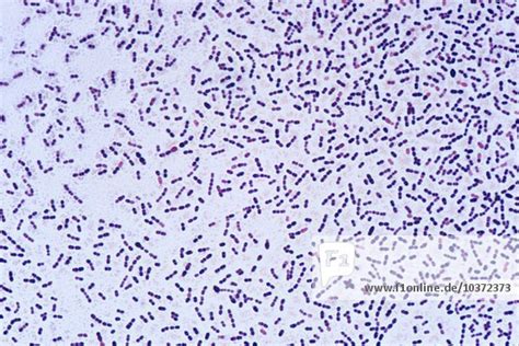 Streptococcus Bacteria Gram Stain