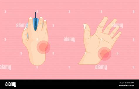 A Vector Of A Hand Having An Issue After Working With A Mouse Click