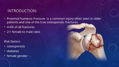 Fracture Of Proximal Humerus Etiopathogenesis Clinical Features And Management Pptx