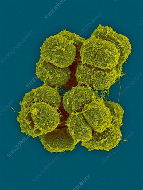 Micrococcus Antarcticus Bacterium SEM Stock Image C Science Photo Library