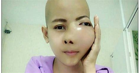 치통으로 알았는데 종양이라니 잔인하게 망가진 그의 얼굴