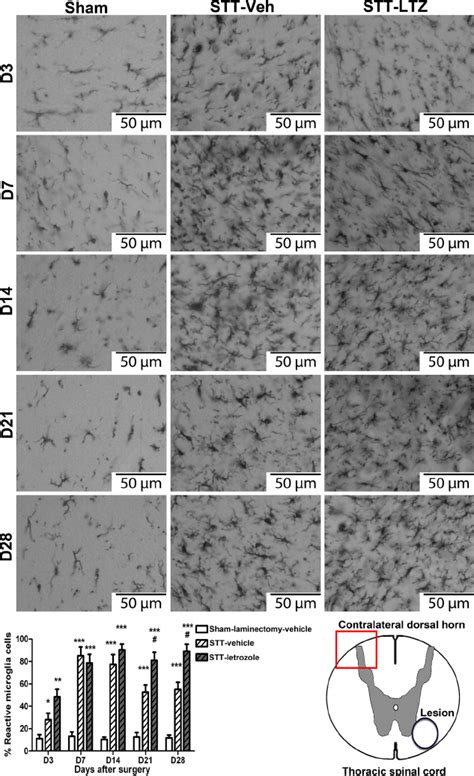 Effects Of Unilateral Lesion Of Spinothalamic Tract On Microglial Download Scientific Diagram