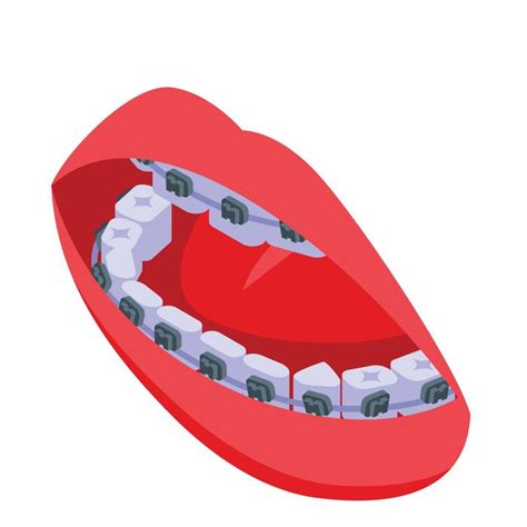 Tooth Braces Vector Art Icons And Graphics For Free Download