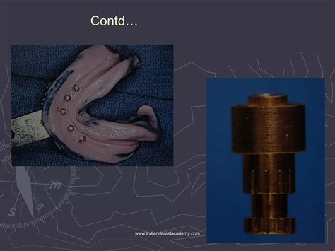 Classification And Impression Techniques Of Implants Dentistry Dental
