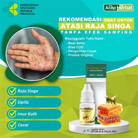 Jual Obat Raja Singa Sipilis Cacar Jamur Kulit Gatal Bernanah Infeksi Kulit Gatal Alergi Kadas
