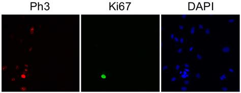 Cell Scoring Bioinfosummer Image Analysis With Fiji Imagej