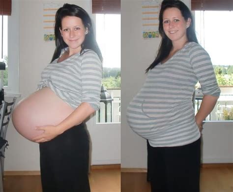 A Womans Belly Mysteriously Keeps Getting Bigger And Bigger Doctors