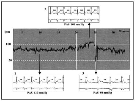 Tilt Table Test Results Cabinets Matttroy
