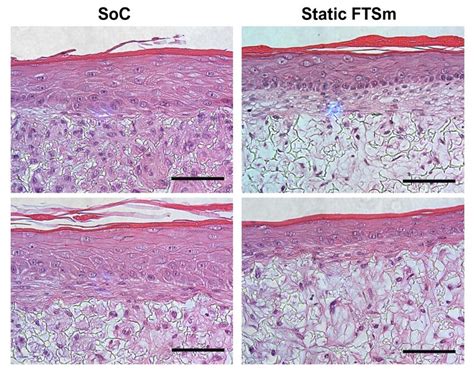 Epidermal Morphogenesis In Full Thickness Skin On A Chip Soc Models