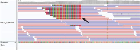 Integrated Genome Viewer Image Of Hpv Integration In Oscc Tumour Download Scientific Diagram