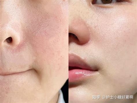 皮肤科医生都是怎么抗老的？你用过哪些真正有效且性价比高的抗衰老护肤品？ 知乎