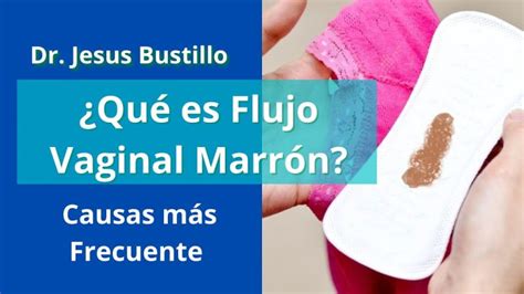 Me Sale Flujo Cafe Despues De Tener Relaciones 2025