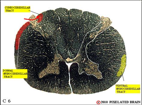 Pixelated Brain Module 6 Section 5 Input From The Spinal Cord