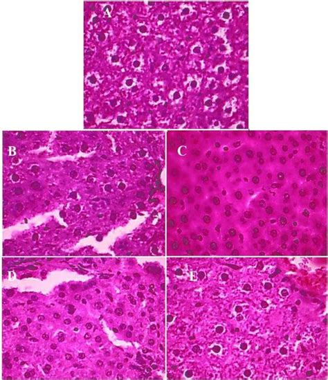 Histological Investigation Of Liver In Vivo Study Of Liver A Control