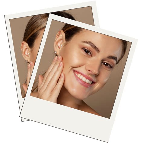 Preenchimento Malar Procedimentos Botocenter