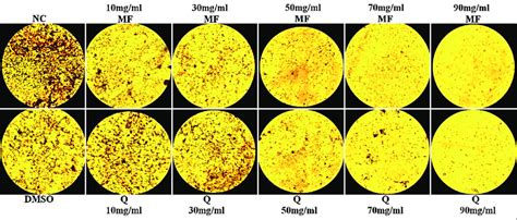 Phase Contrast Microscopic Analysis Of Bacillus Subtilis Biofilm Nc