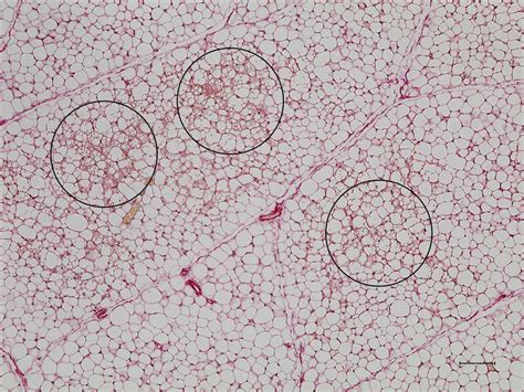 Une Nouvelle Technique Permet De Transformer Les Cellules Adipeuses