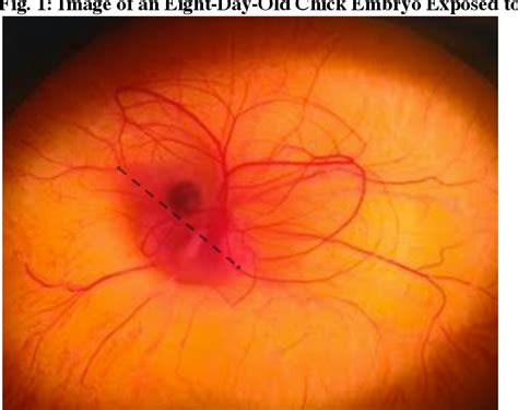 Figure 1 From Fetal Alcohol Syndrome On Notochord Induction In Chick