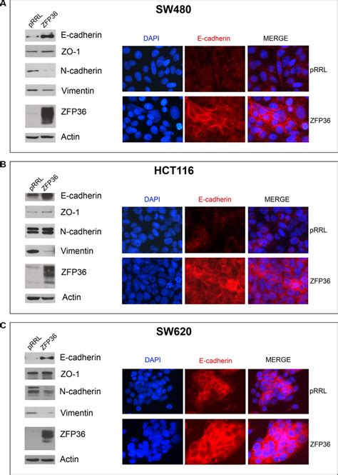 Analysis Of Epithelial Markers In Zfp36 Overexpressing Cells Sw480