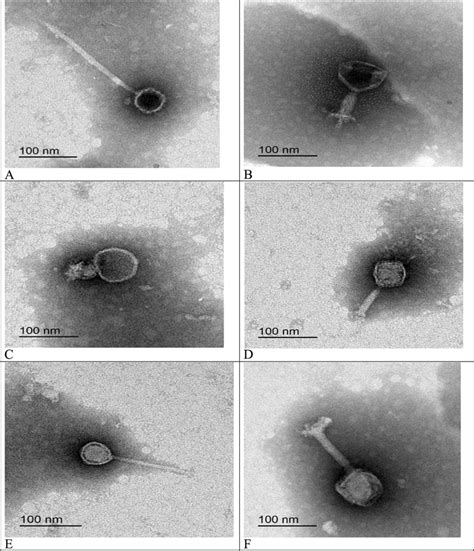 Transmission Electron Microscopy Photograph Of Isolated Listeria
