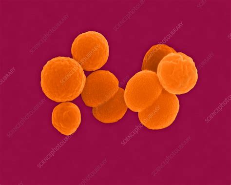 Neisseria Meningitidis Coccus Prokaryote Sem Stock Image C032 2651 Science Photo Library