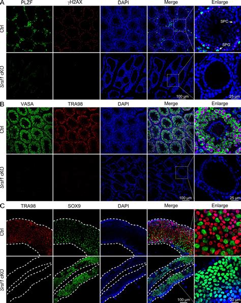 Splicing Factor Srsf1 Is Essential For Homing Of Precursor