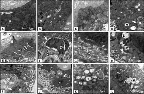 Transmission Electron Microscopy Photomicrographs Of Mid Gut Cells Of