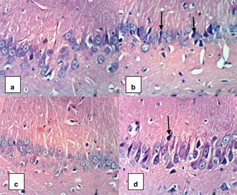 A Photomicrograph Of Brain Tissue Section Of Rat From Control And