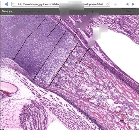 Endochondral Bone Formation Histology
