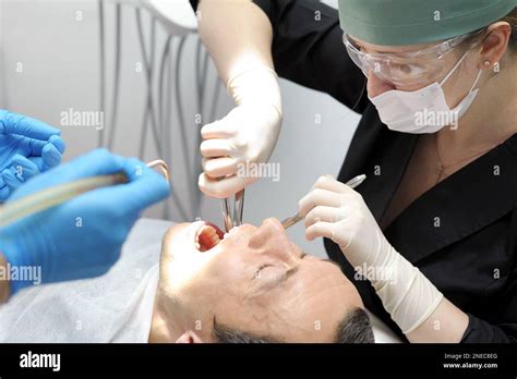 Dentist Removes Wisdom Tooth With Special Forceps With Force Dentist