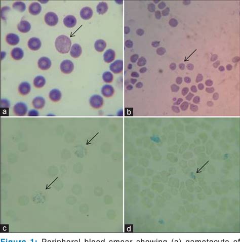 Simple Stain Methylene Blue