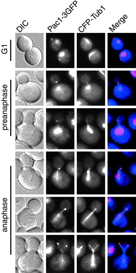 Pac13gfp Colocalizes With The Distal Ends Of Cytoplasmic Microtubules