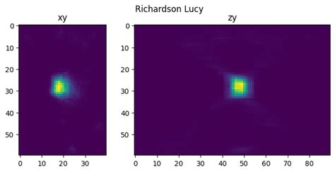 Deconvolution Vs Ai Deblurring For Microscopy Image Analysis Image Sc Forum