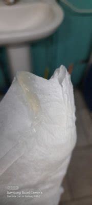 Flujo Vaginal Es Normal Babycenter