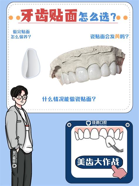 合肥瓷贴面去哪好？什么情况需要做牙贴面？有些人不能做瓷贴面？ 知乎