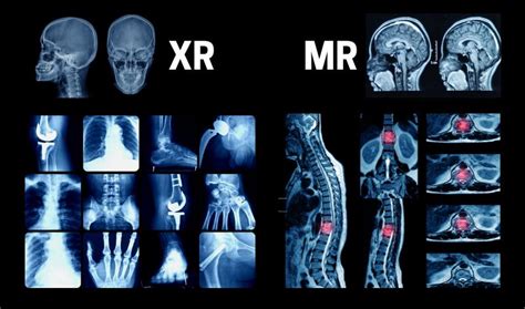 Mri Vs X Ray Whats The Difference