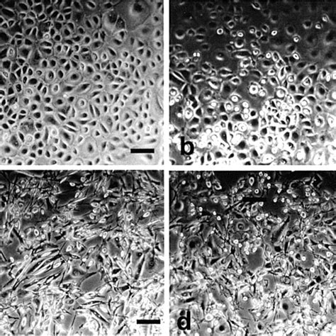 Pdf Menstrual Effluent Induces Epithelial Mesenchymal Transitions In