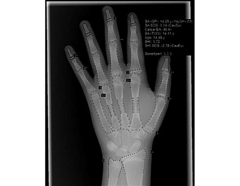 Current State Of Community Driven Radiological Ai Deployment In Medical