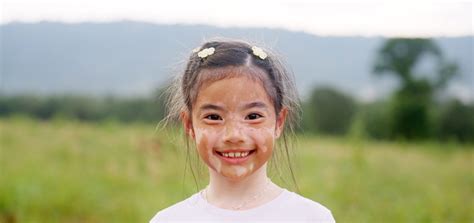 Los Nuevos Criterios De Clasificación Acreular Medizinonline