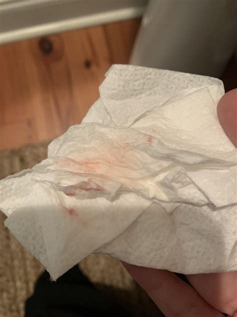 Implantation Bleeding Or Miscarriage Rtryingtoconceive