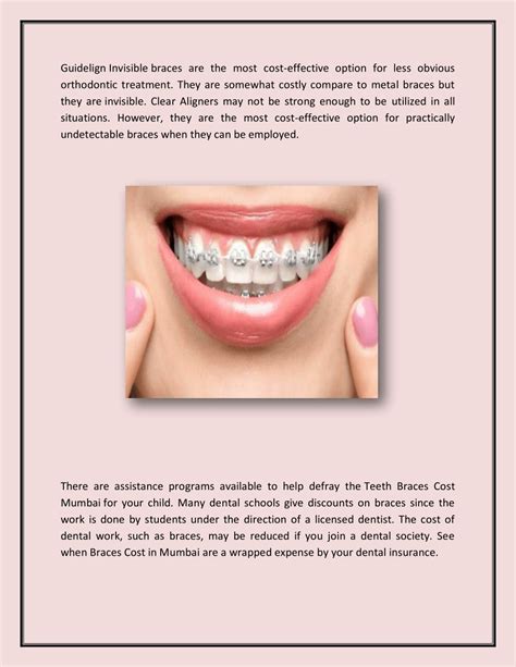 Ppt Do You Want To Know The Cost Of Invisible Braces Powerpoint