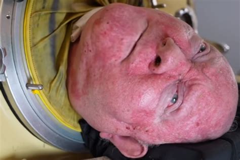 Paul Alexander O último homem que vive um pulmão de ferro