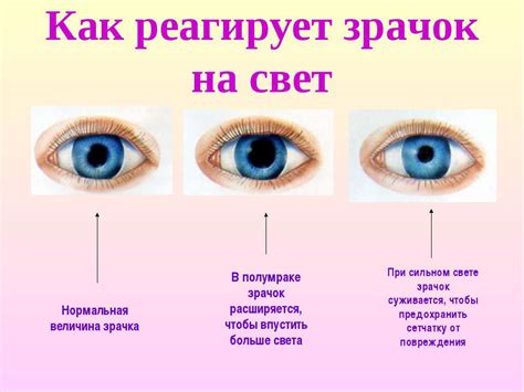 Расширение зрачков - причины